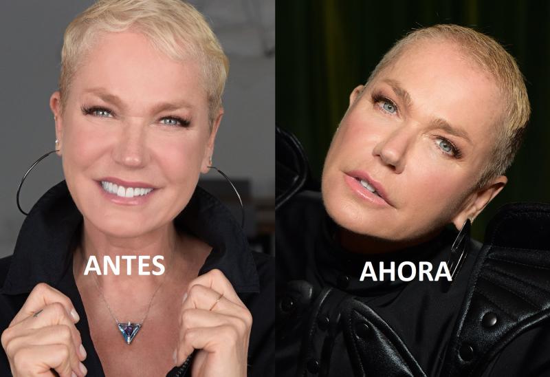 Xuxa Se Realiza 80 Procedimientos Estéticos En 7 Horas A Sus 61 Años
