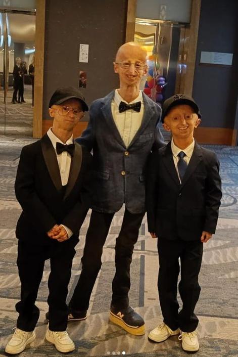 Muere Sammy Basso, la persona con progeria más longeva del mundo | T13
