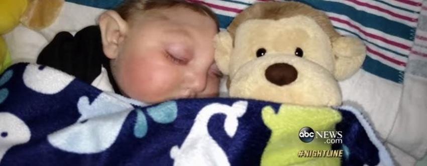 Niño Milagro Que Nació Sin El 80 Del Cerebro Murió A Los 5 Años