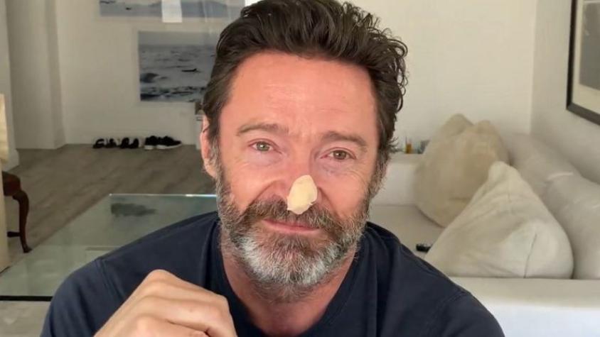 ¡Fuerza Wolverine! Hugh Jackman se somete a dos biopsias para descartar ...