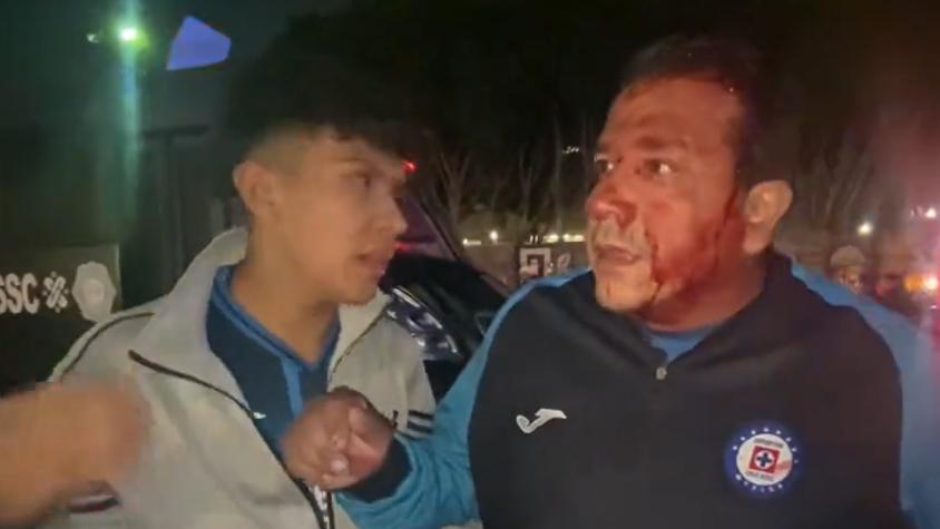 "Me abrieron la cabeza": Hincha de Cruz Azul denuncia brutal agresión ...